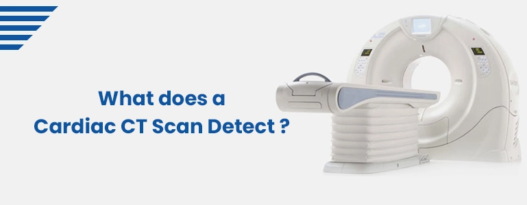 What does a Cardiac CT Scan Detect? | Sprint Diagnostics Hyderabad
