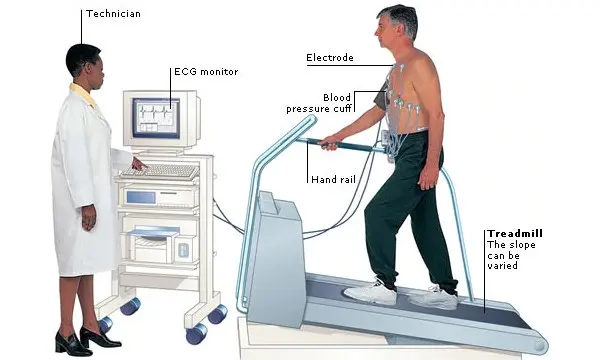 Are You Looking for a Treadmill Test (TMT) Scan Near You?