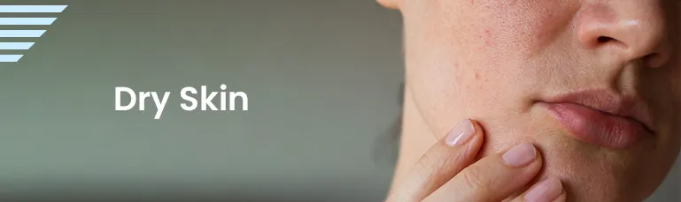 Diagnostics Test for Dry Skin Symptom | Sprint Diagnostics Hyderabad