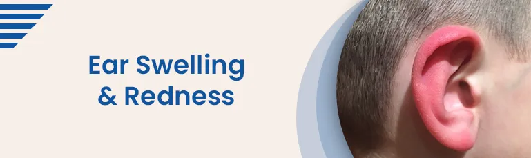 Ear swelling and Redness Test Symptom | Sprint Diagnostics Hyderabad