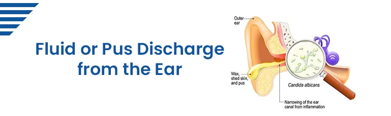Fluid or Pus Discharge from the Ear : Causes, Diagnostic Tests & Treatments